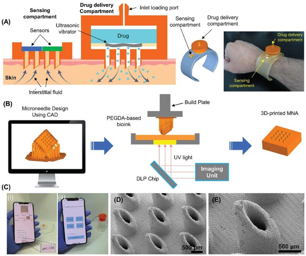 3D-printed microneedles could streamline remote health monitoring ...