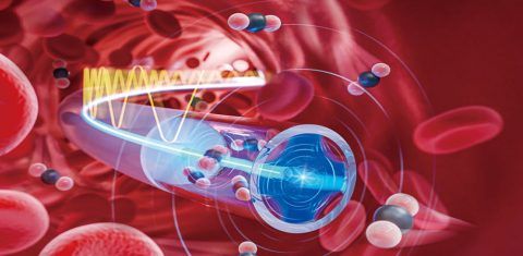 Miniaturized photoacoustic spectrometer enables intravascular blood gas ...
