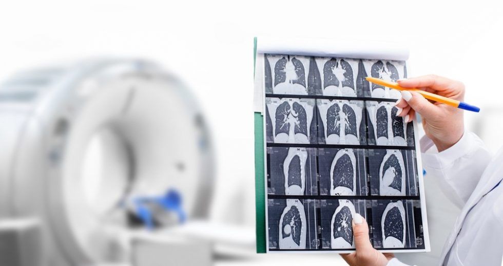 AI-based simulator for diagnosing interstitial lung diseases | Radar ...